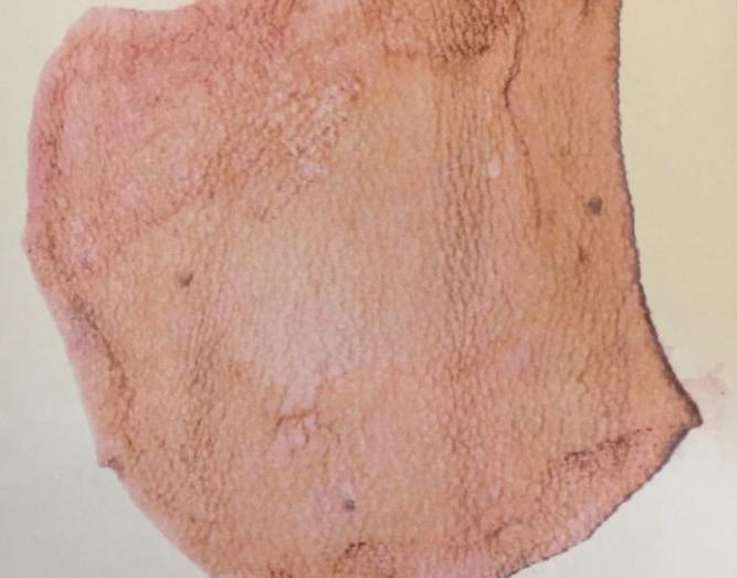 Flådd på sin egen nyttårsfest – Document